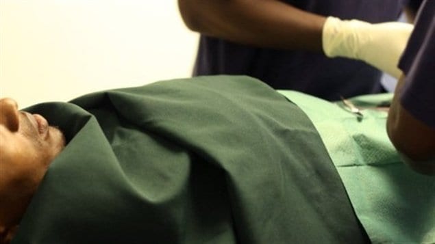 Circoncision Masculine; circoncision