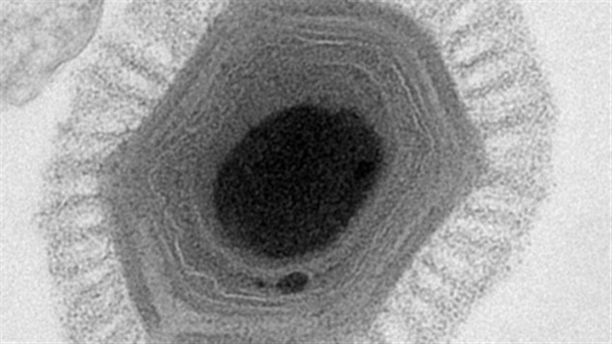 Le virus de tous les records | Radio-Canada