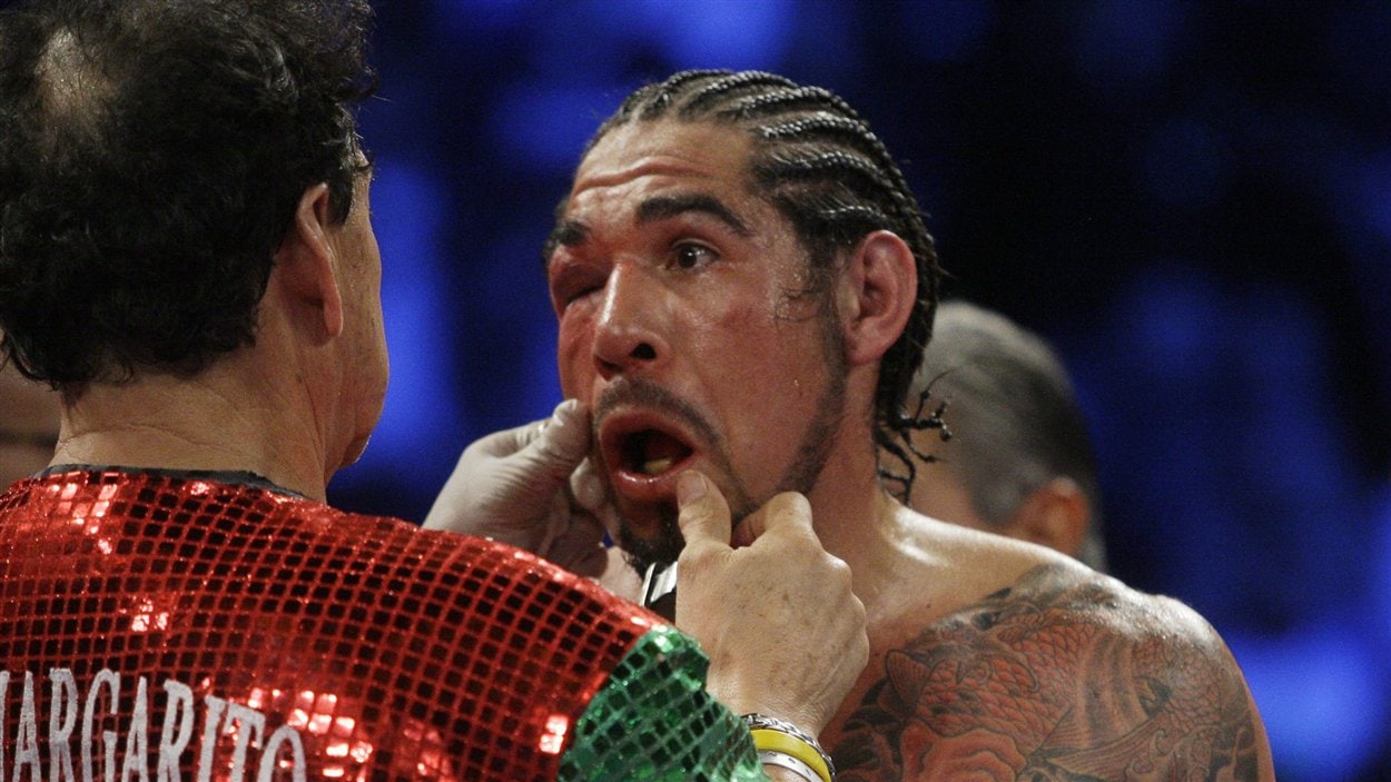 Margarito accroche ses gants | Radio-Canada