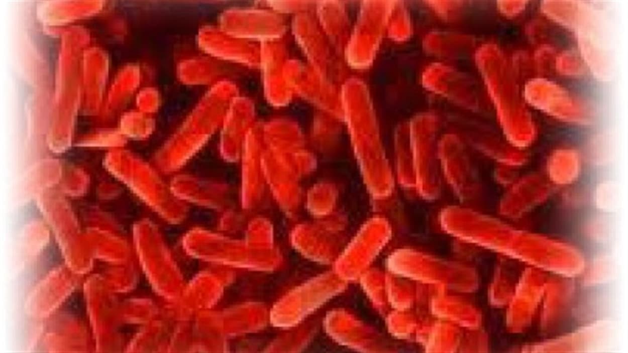 Un seul nouveau cas de légionellose est rapporté | Radio-Canada