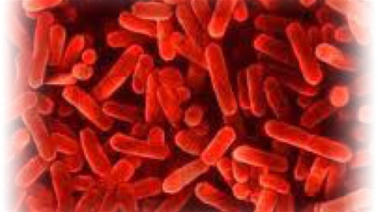 Légionellose : un 2e cas en Mauricie et au Centre-du-Québec | Radio-Canada