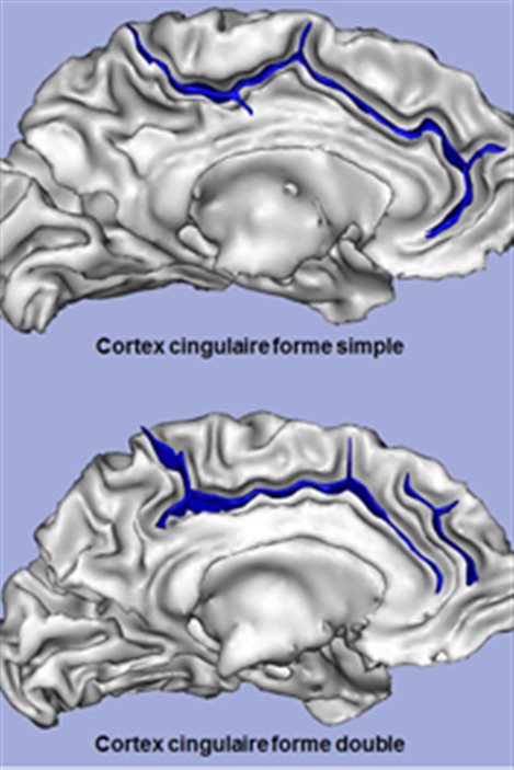 Apprentissage : la forme du cerveau en question | Radio-Canada