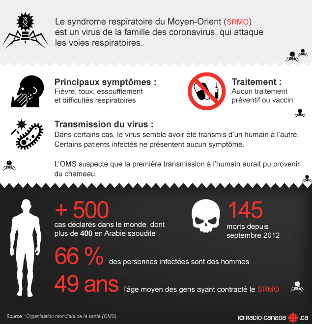 Le SRMO, c'est quoi? | Radio-Canada