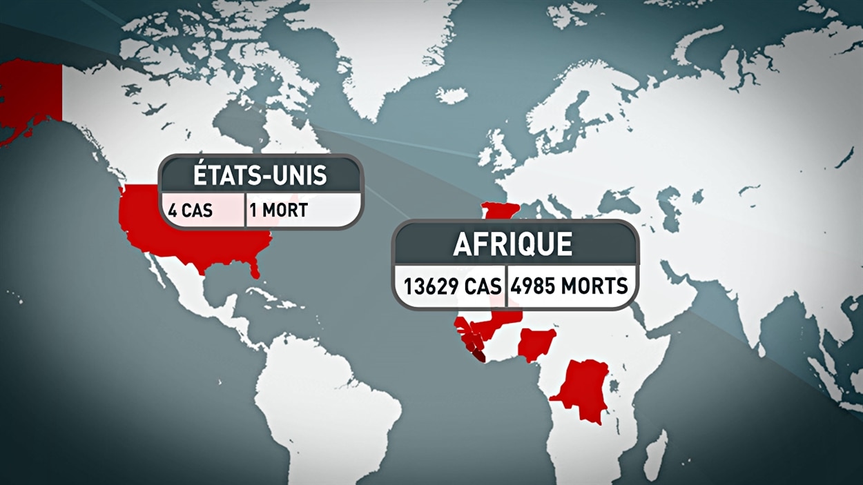 Ebola : le point sur l'épidémie | Radio-Canada