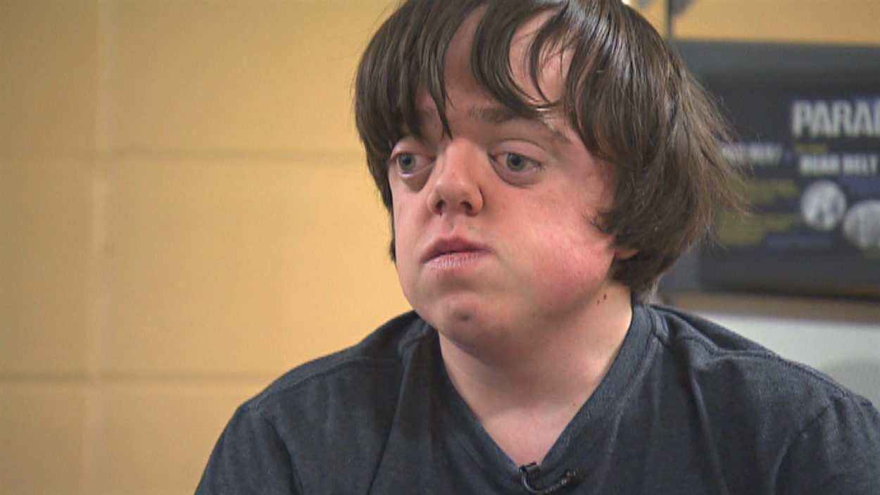 Un nouveau visage pour un jeune Trifluvien | Radio-Canada.ca