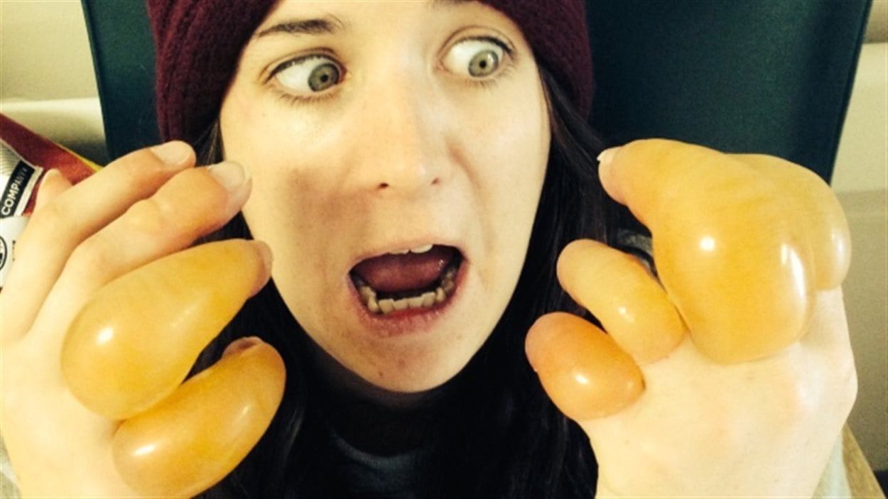 Terrible cas d'engelure après être restée dehors en Saskatchewan ...