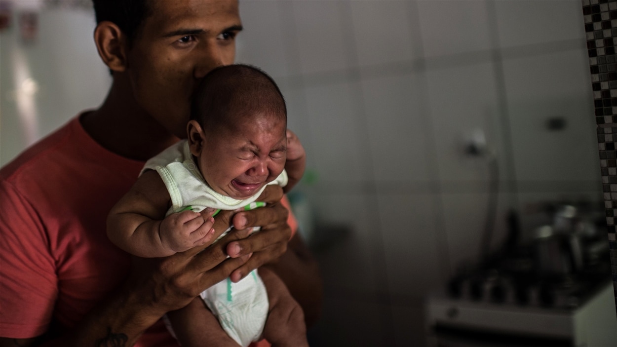 Le lien entre le virus Zika et les malformations cérébrales se confirme ...