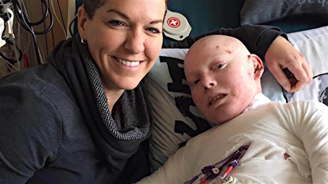 Le gouvernement de l'Ontario ouvert à payer une deuxième greffe à ...